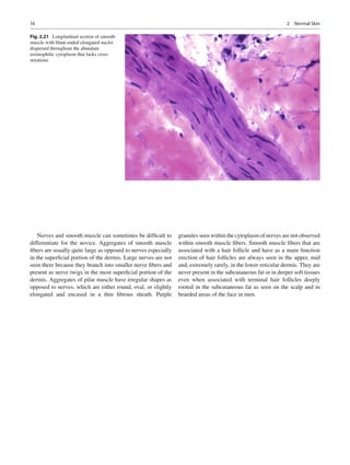 Atlas of practical mohs histopathology | PDF