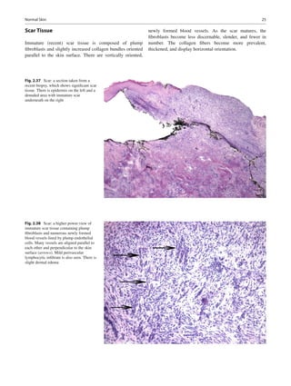 Atlas of practical mohs histopathology | PDF