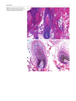 Atlas of practical mohs histopathology | PDF