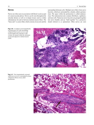 Atlas of practical mohs histopathology | PDF