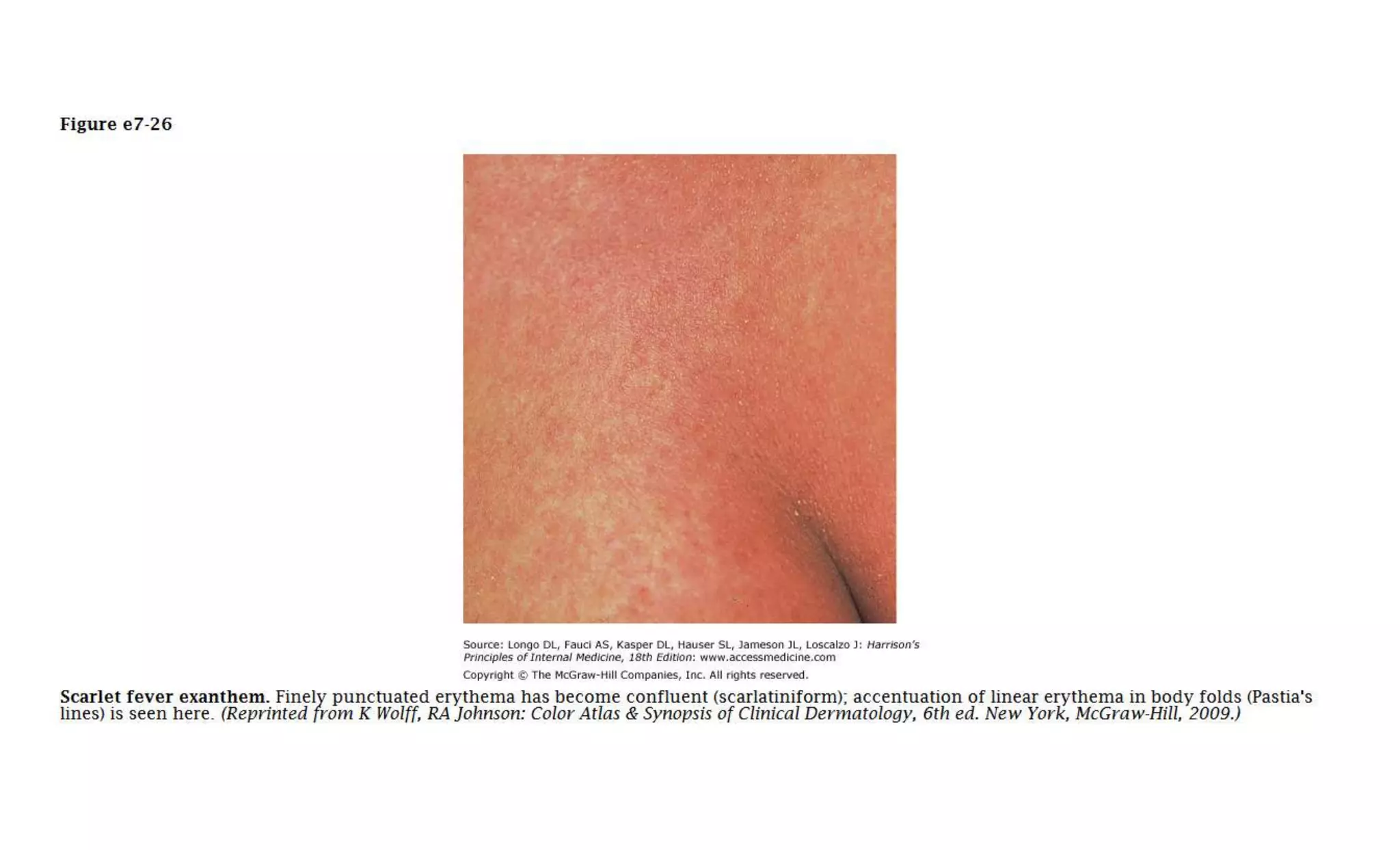 Atlas of Rashes Associated with Fever.pptx