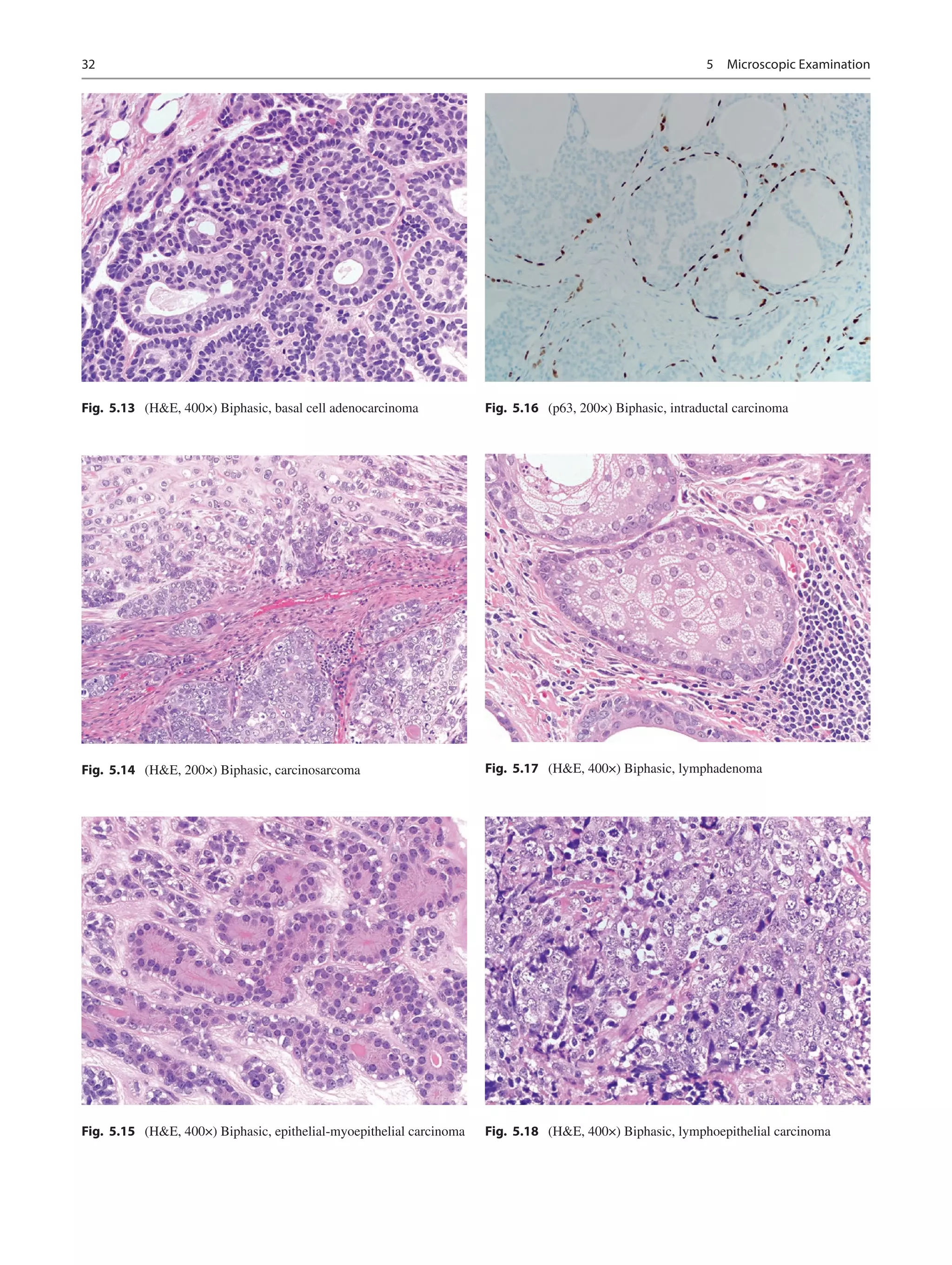 Atlas of salivary gland pathology | PDF