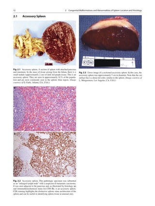 Atlas of spleen pathology | PDF