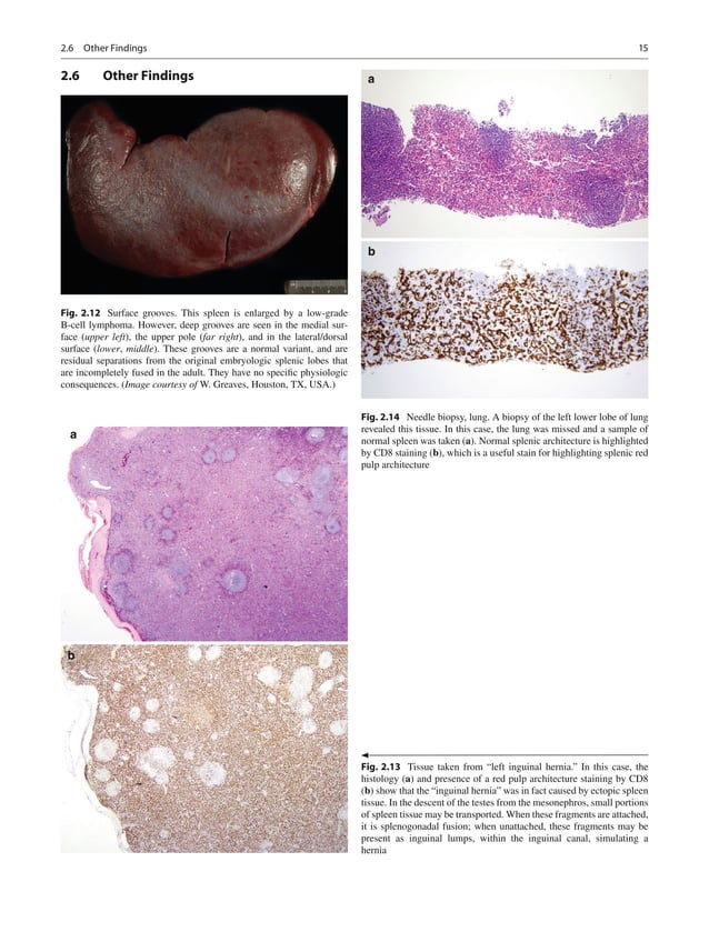 Atlas of spleen pathology | PDF | Digestive Disorders | Diseases and ...