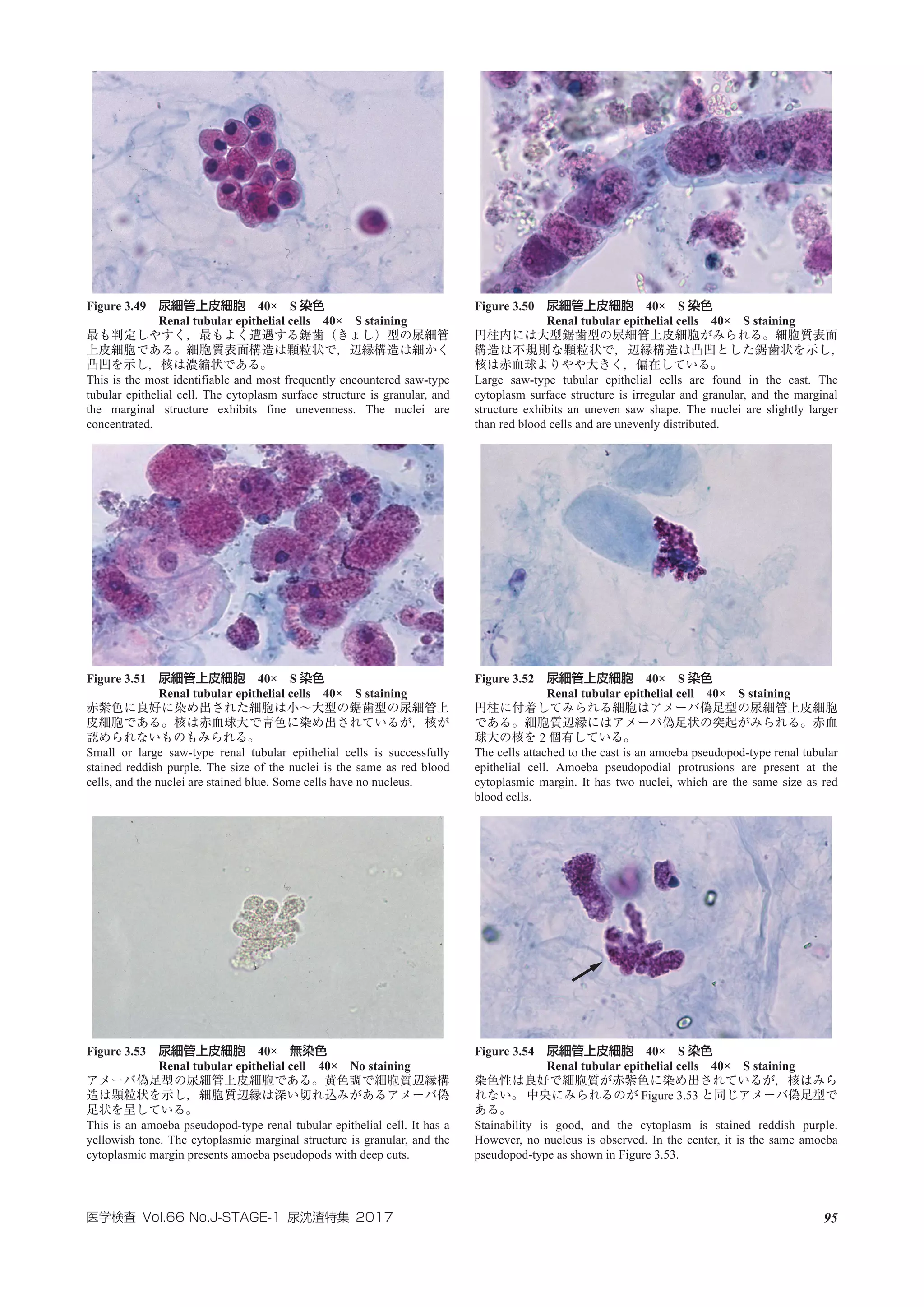 Atlas of urinary_sediment | PDF