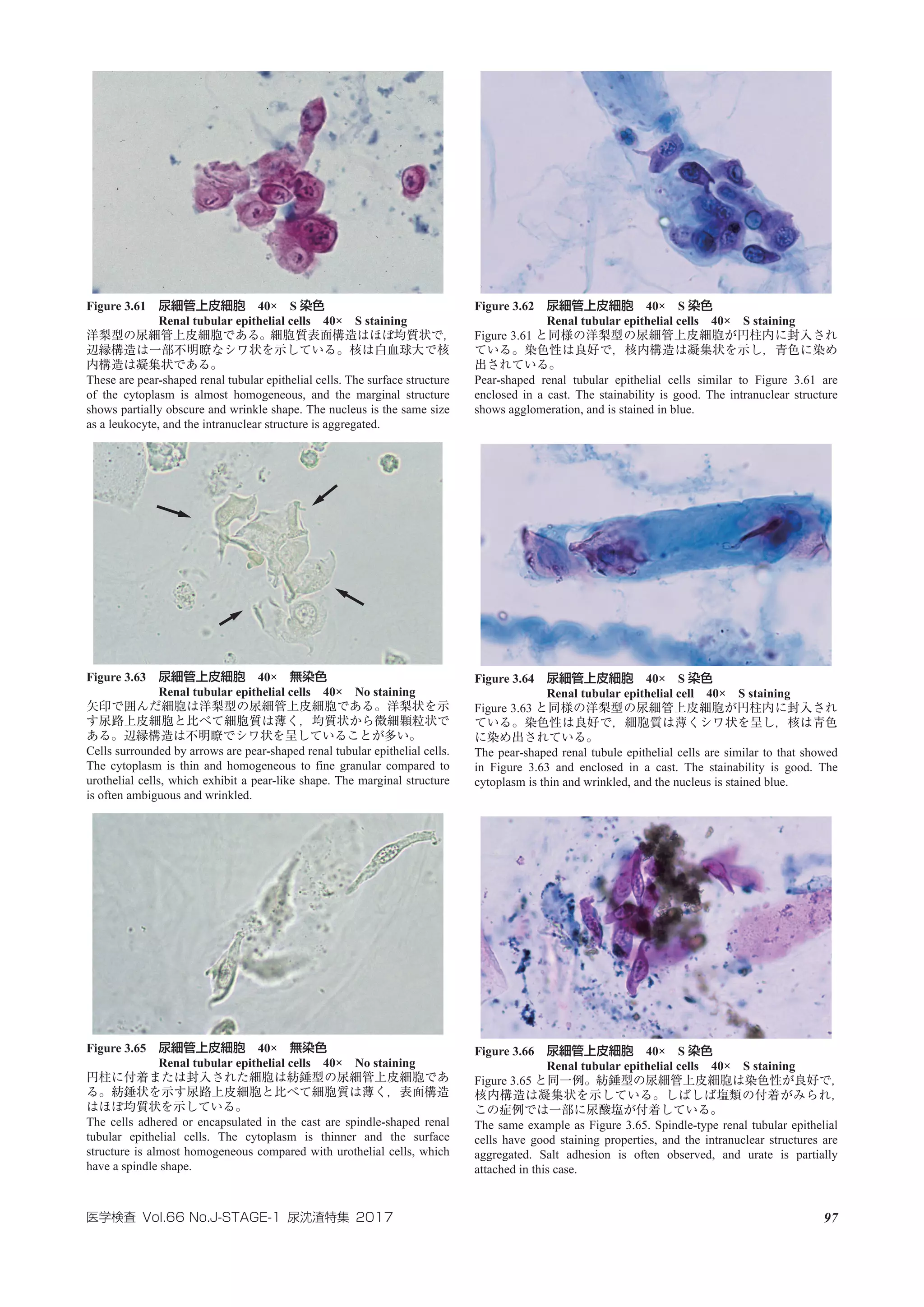 Atlas of urinary_sediment | PDF