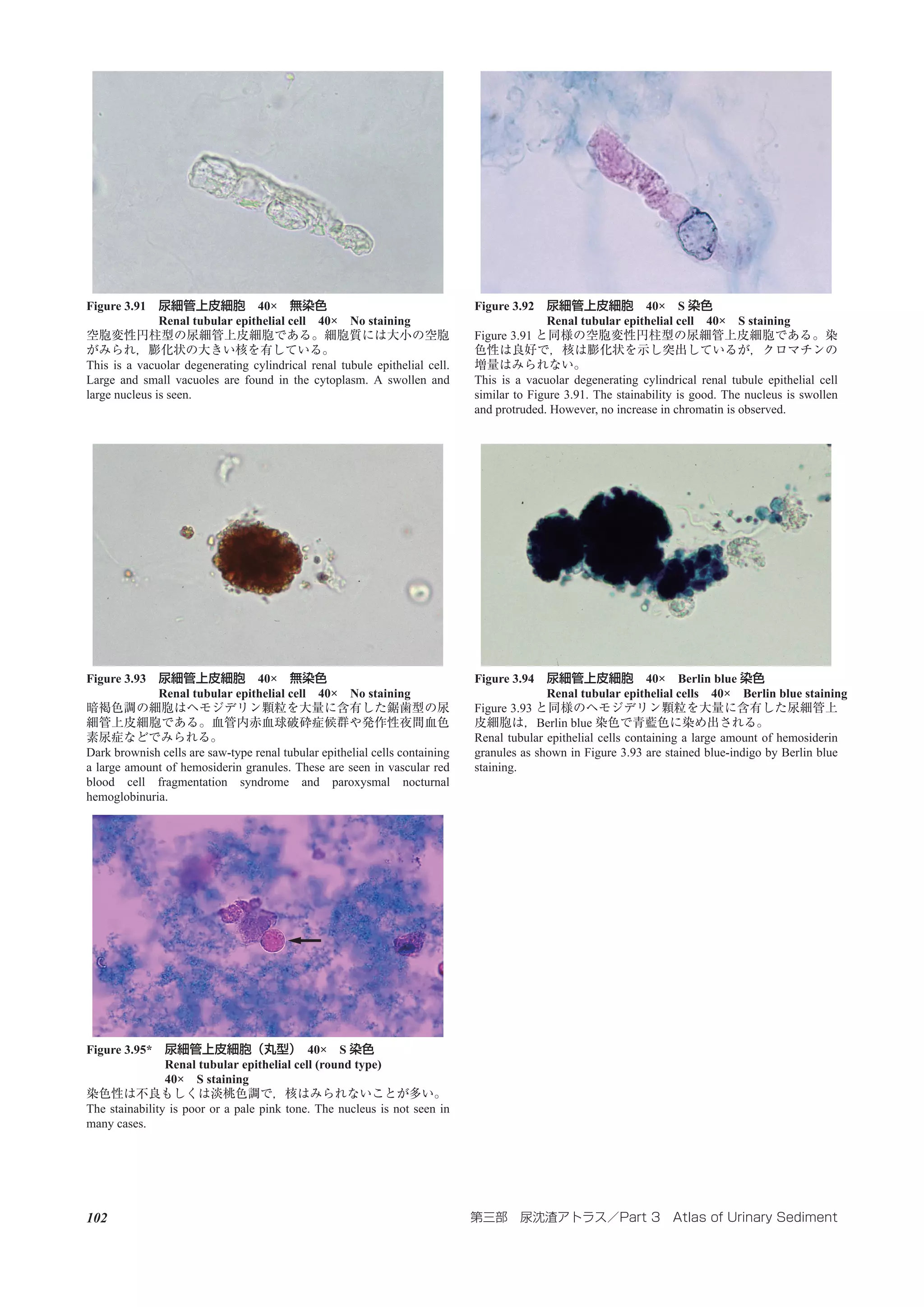 Atlas of urinary_sediment | PDF
