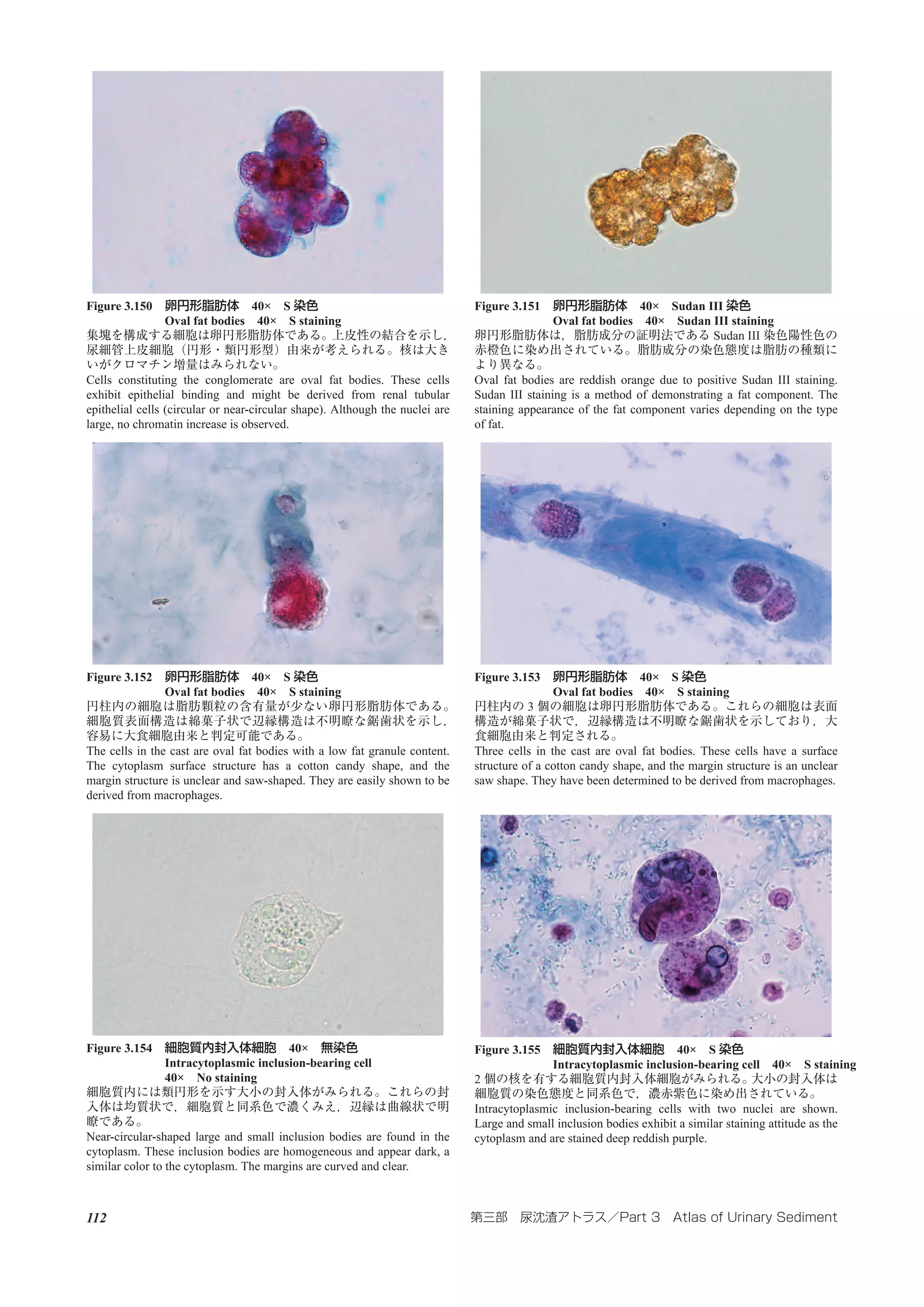 Atlas of urinary_sediment | PDF