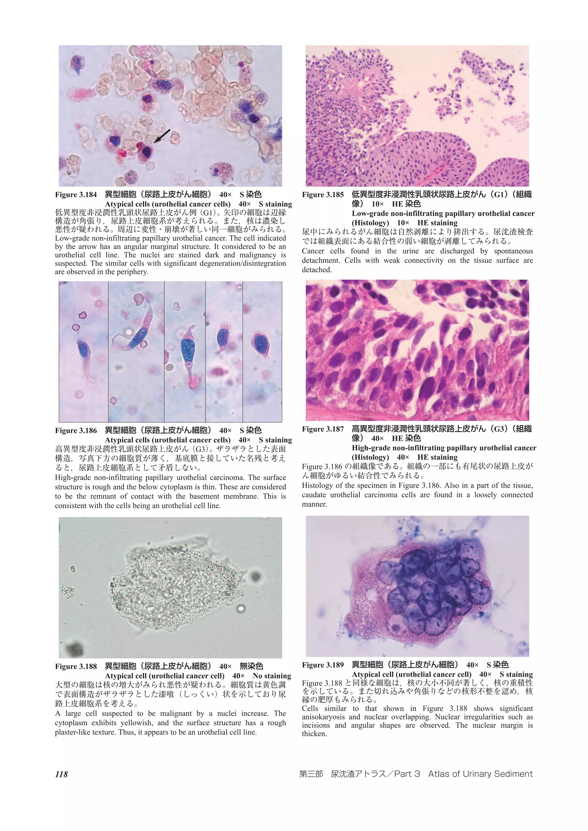 Atlas of urinary_sediment | PDF