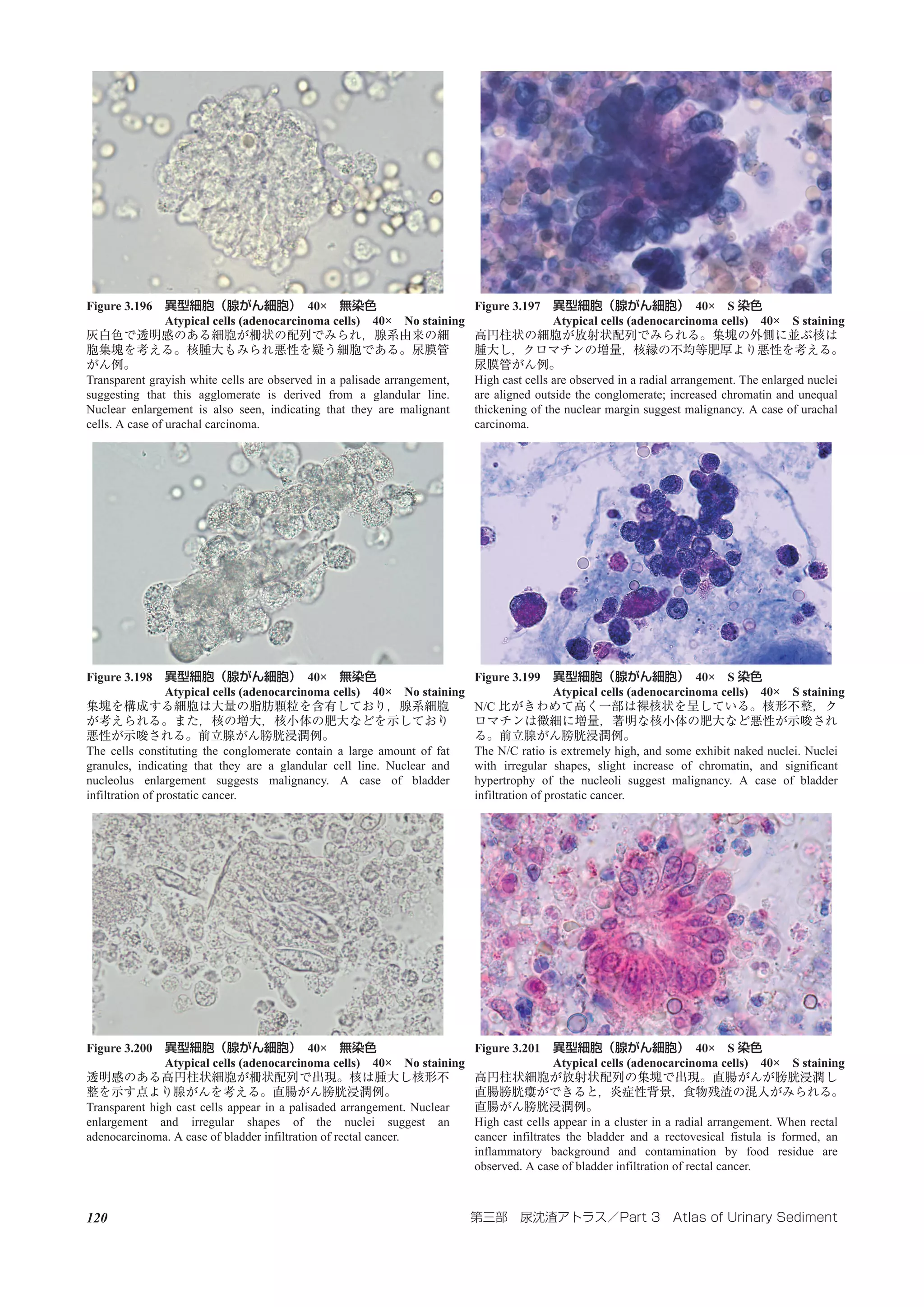 Atlas of urinary_sediment | PDF