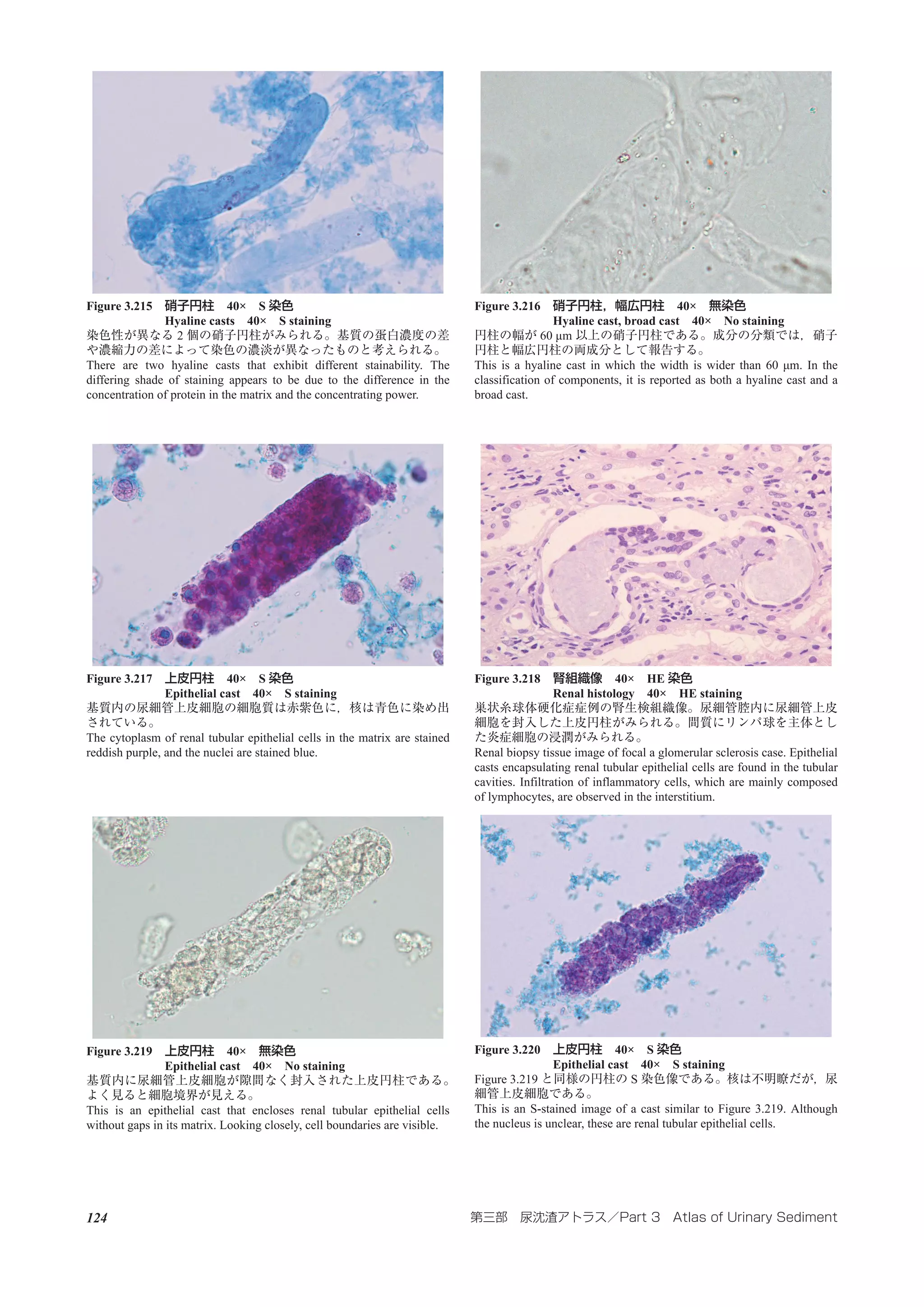Atlas of urinary_sediment | PDF