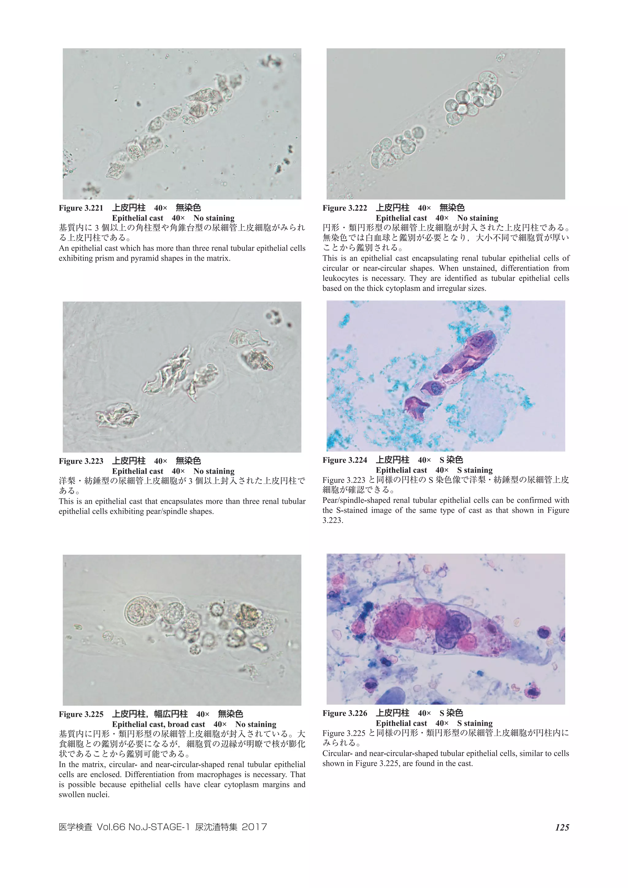 Atlas of urinary_sediment | PDF