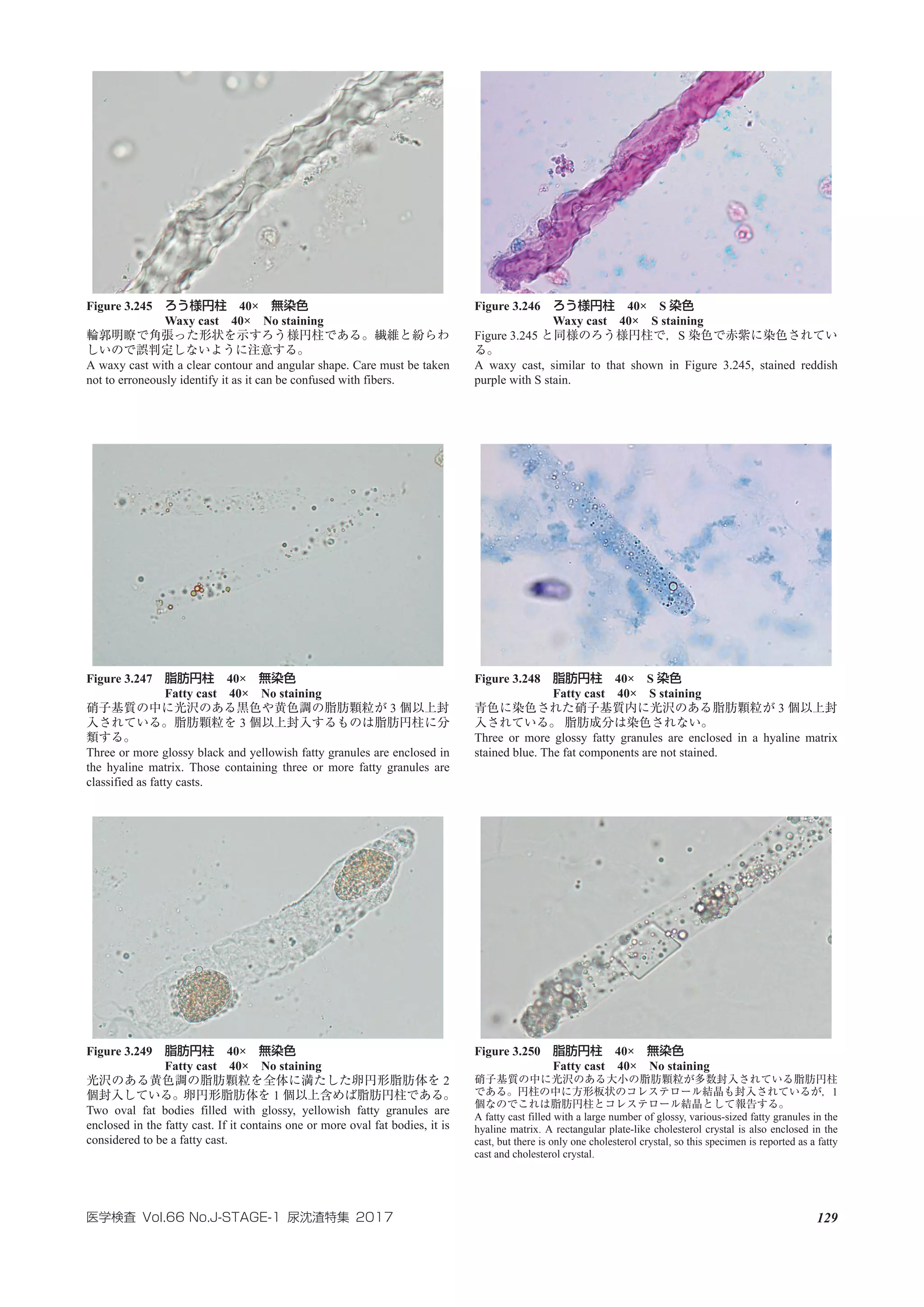 Atlas of urinary_sediment | PDF