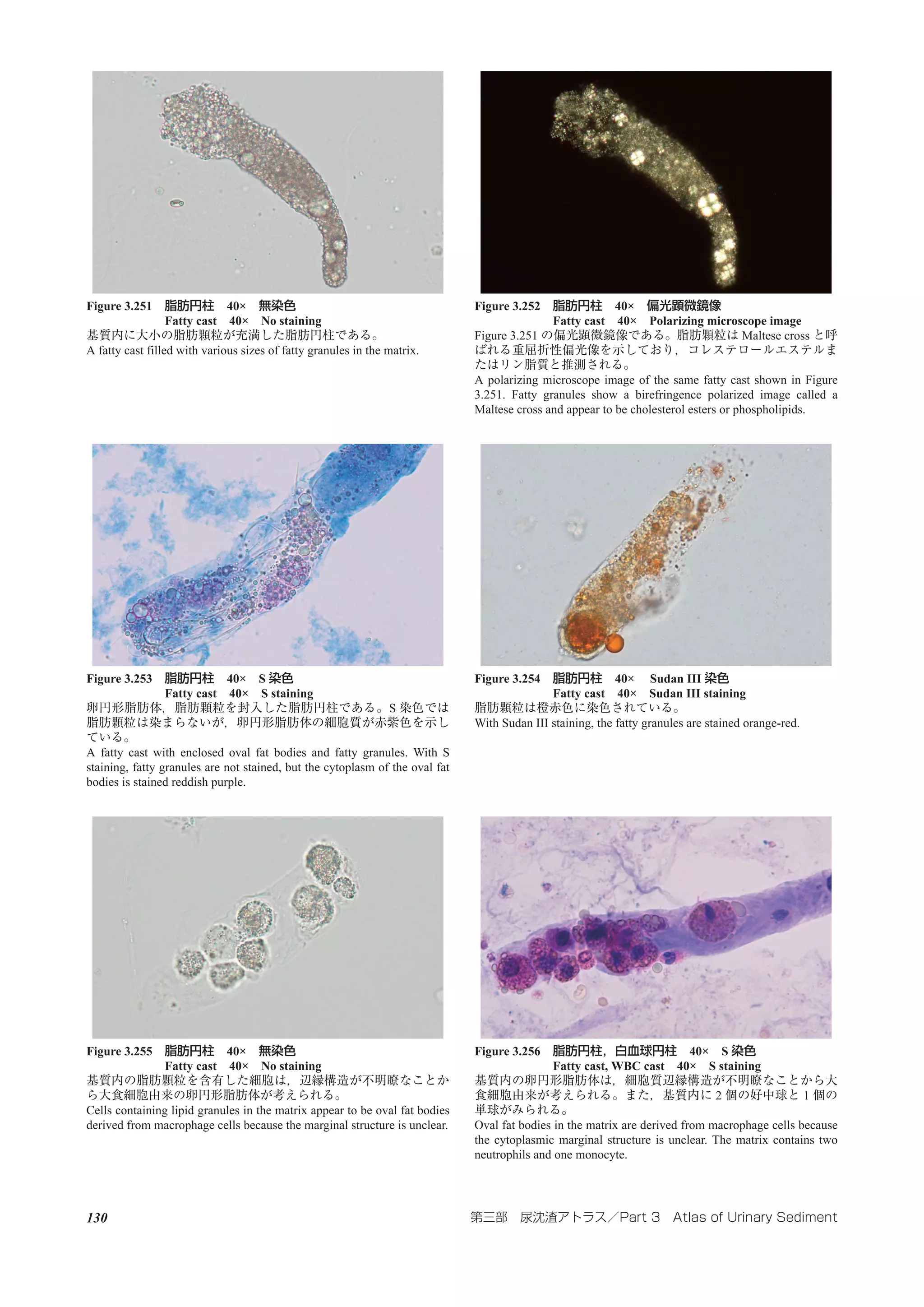 Atlas of urinary_sediment | PDF