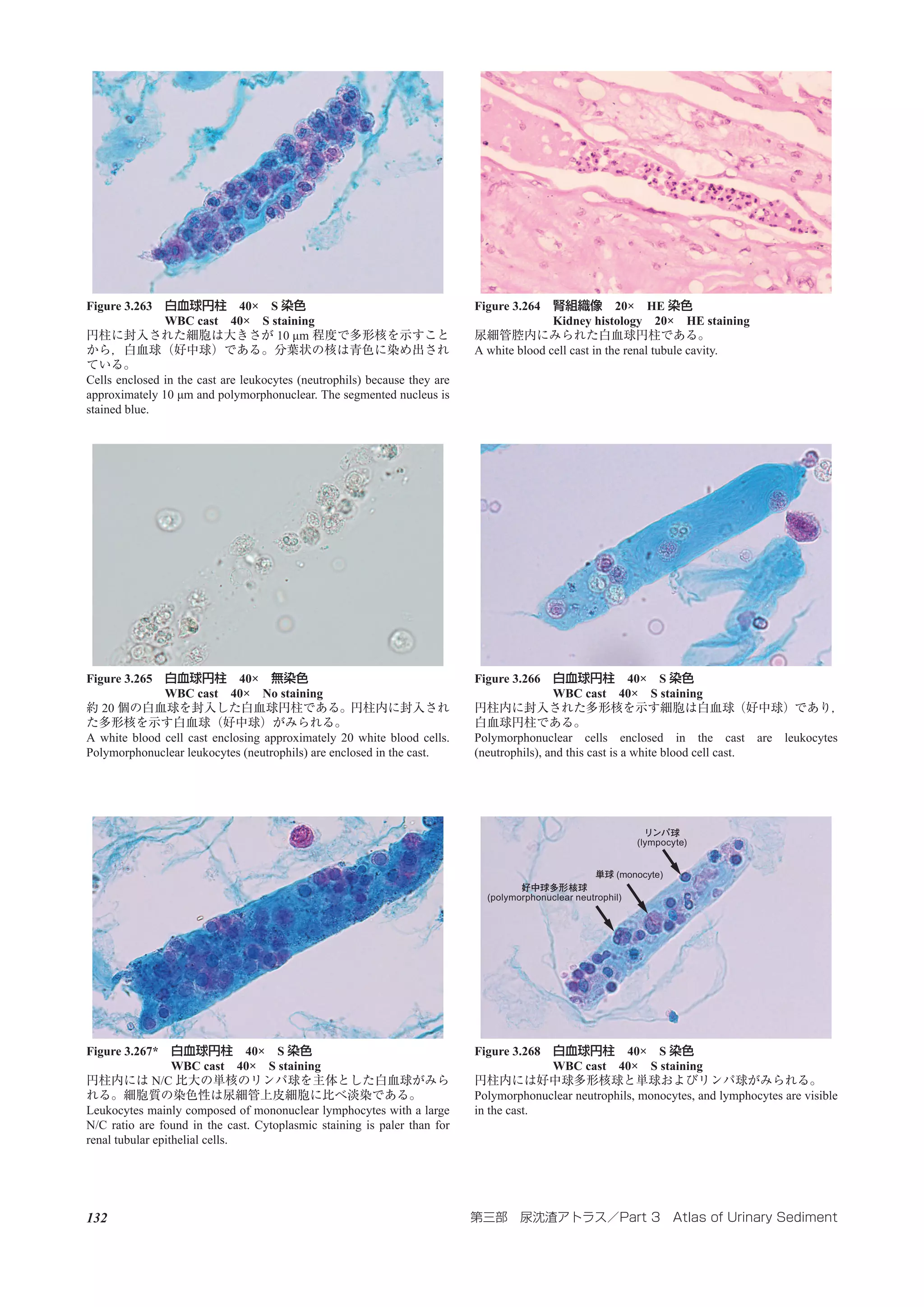 Atlas of urinary_sediment | PDF