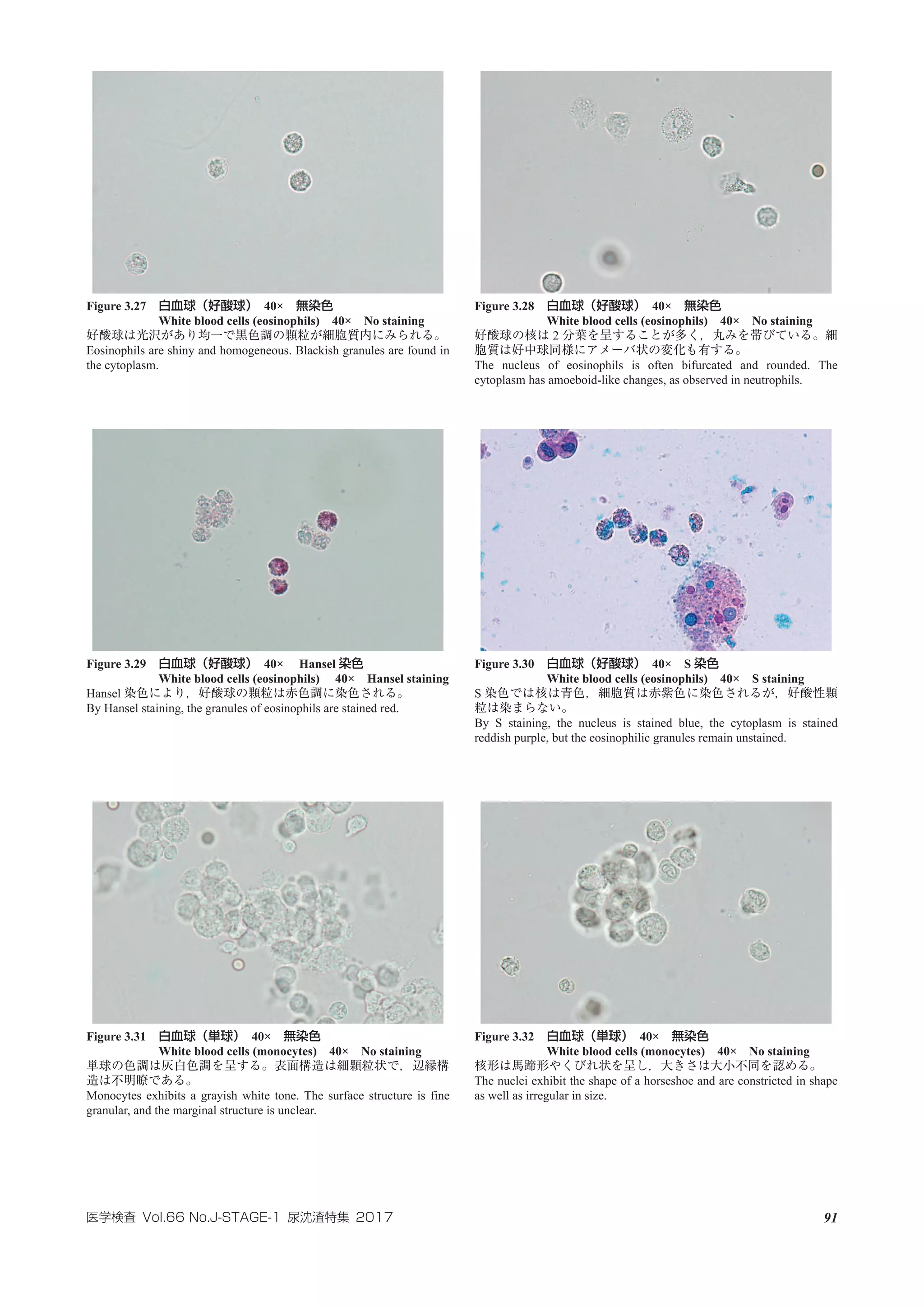 Atlas of urinary_sediment | PDF