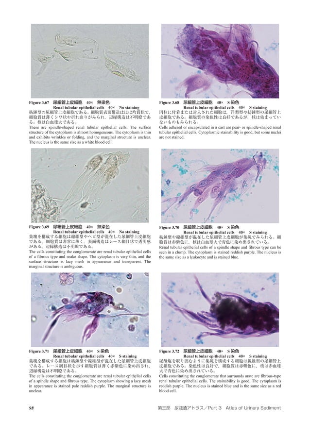 Atlas of urinary_sediment | PDF