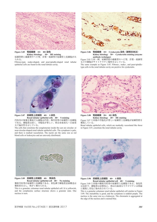 Atlas of urinary_sediment | PDF