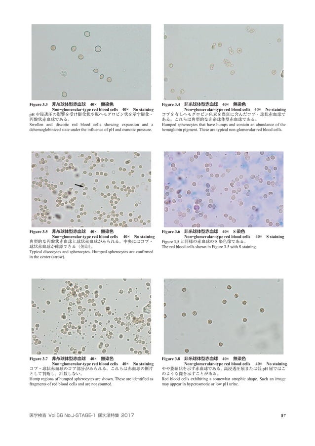 Atlas of urinary_sediment | PDF
