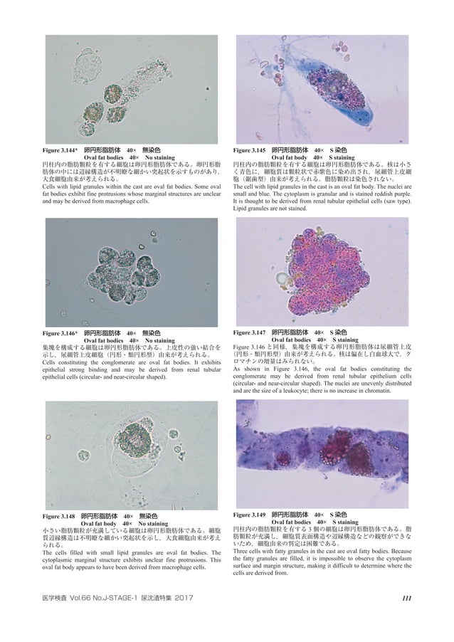 Atlas of urinary_sediment | PDF