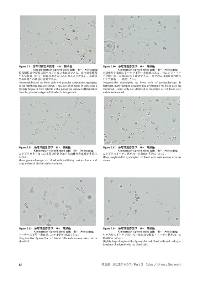 Atlas of urinary_sediment | PDF