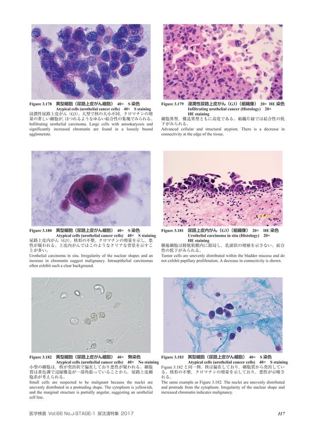 Atlas of urinary_sediment | PDF