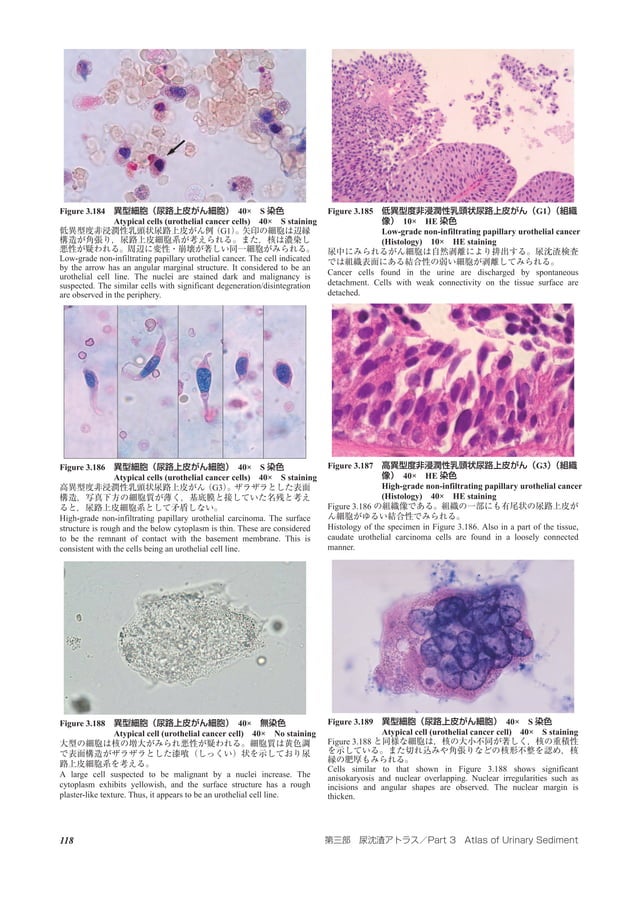 Atlas of urinary_sediment | PDF