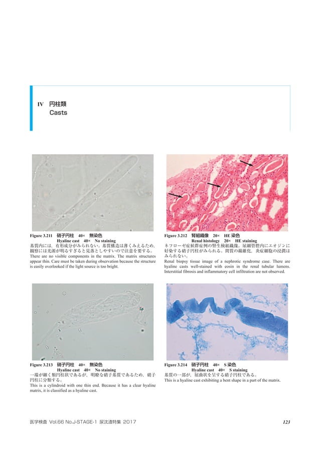 Atlas of urinary_sediment | PDF