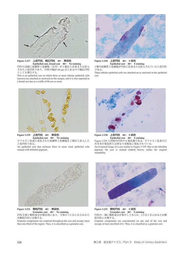 Atlas of urinary_sediment | PDF