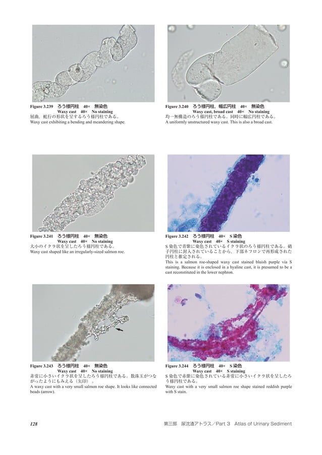 Atlas of urinary_sediment | PDF