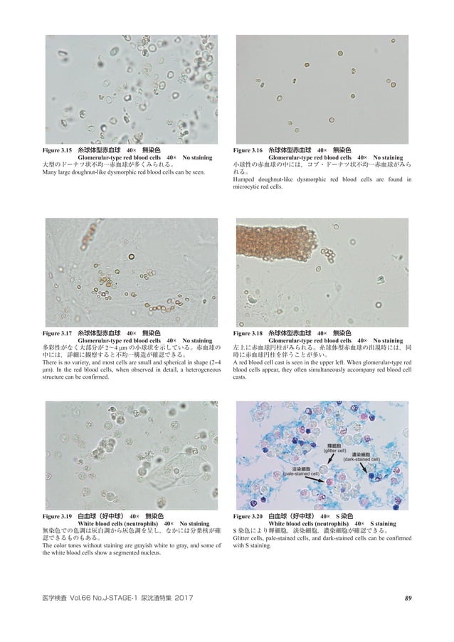 Atlas of urinary_sediment