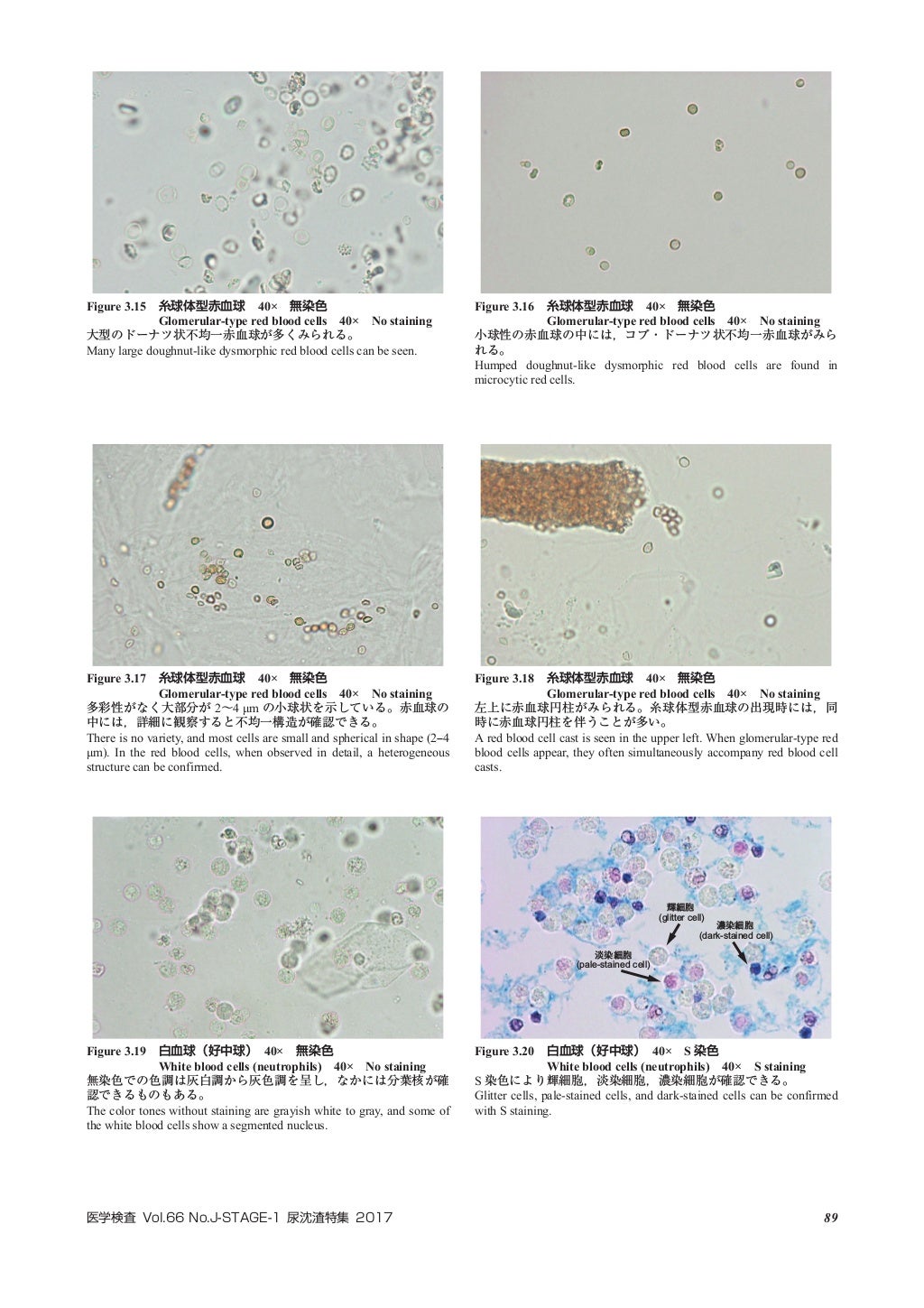 Atlas of urinary_sediment