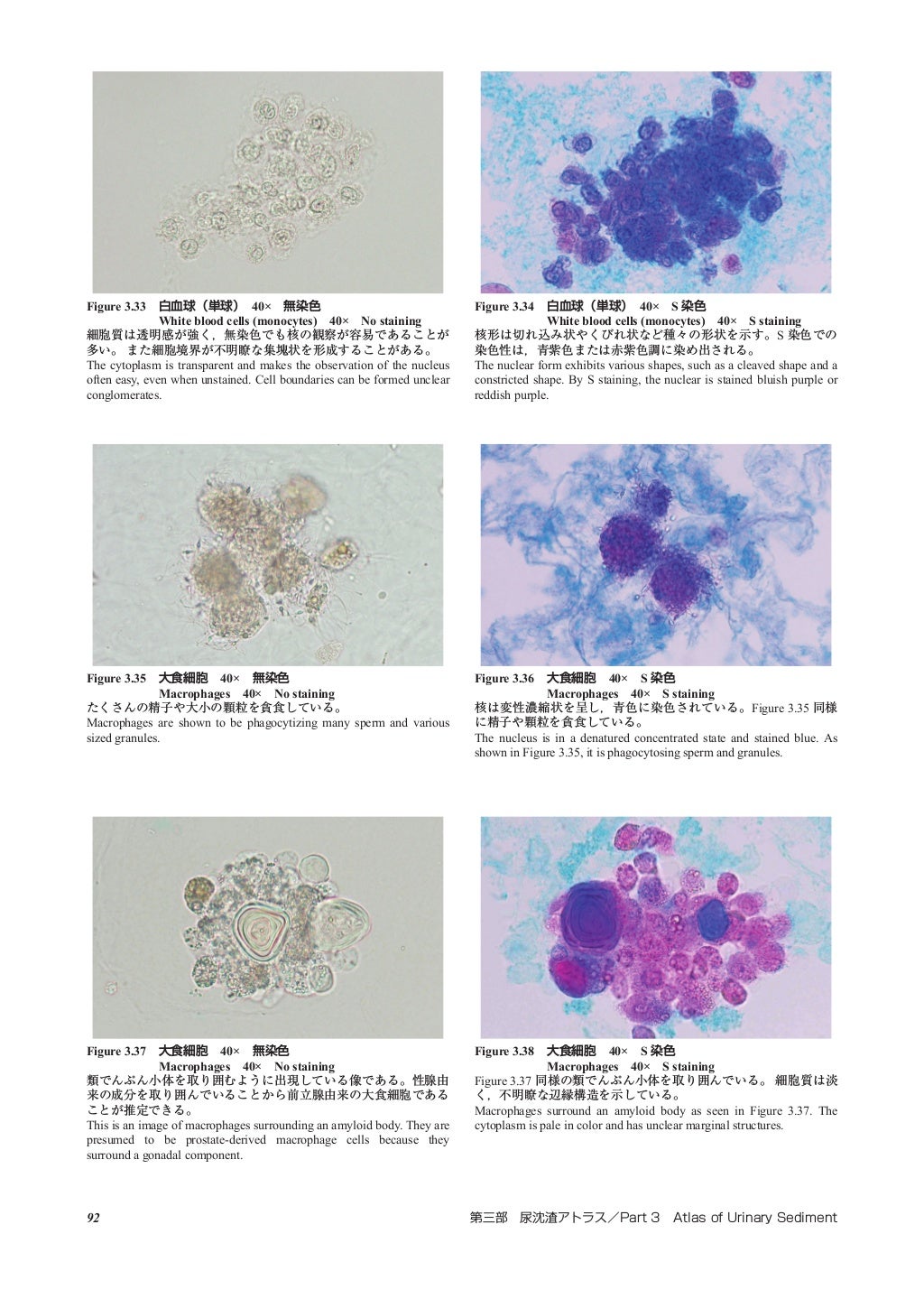 Atlas of urinary_sediment
