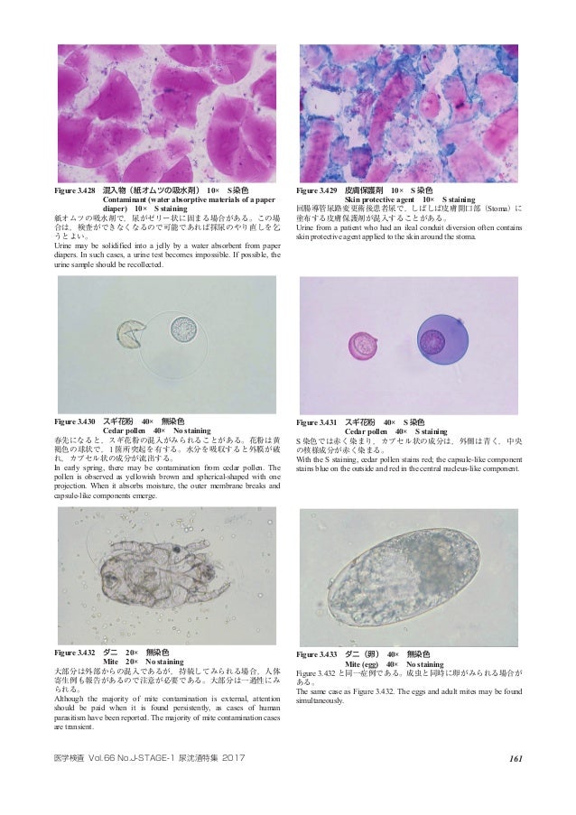 Atlas of urinary_sediment