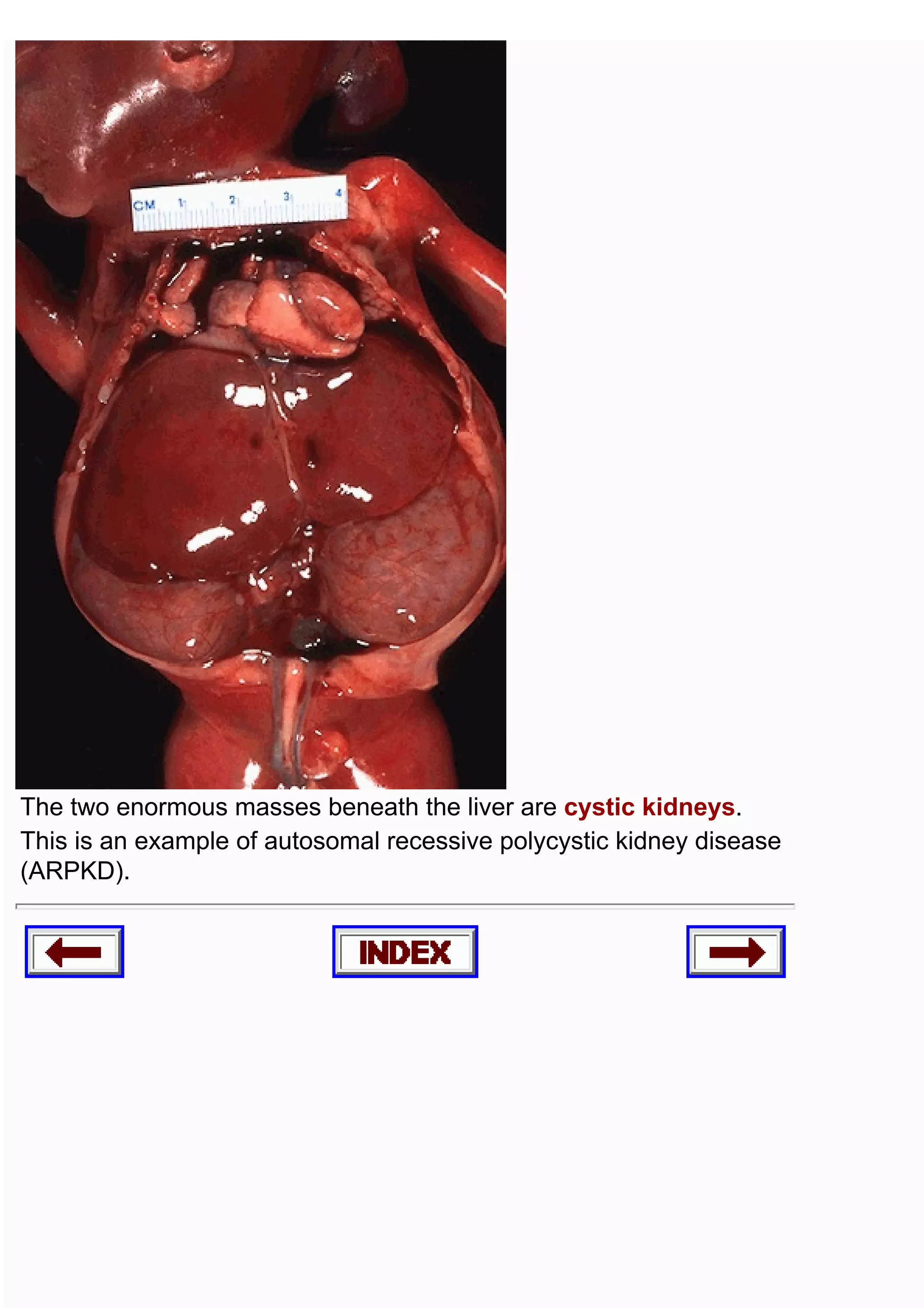 Atlas pediatric perinatal pathology | PDF