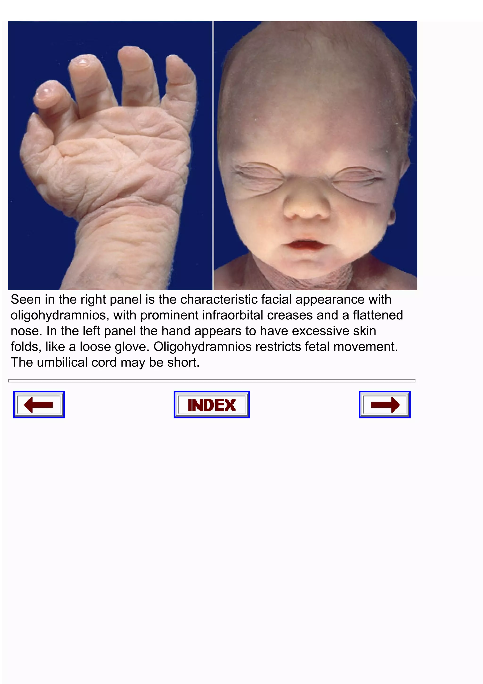 Atlas pediatric perinatal pathology | PDF