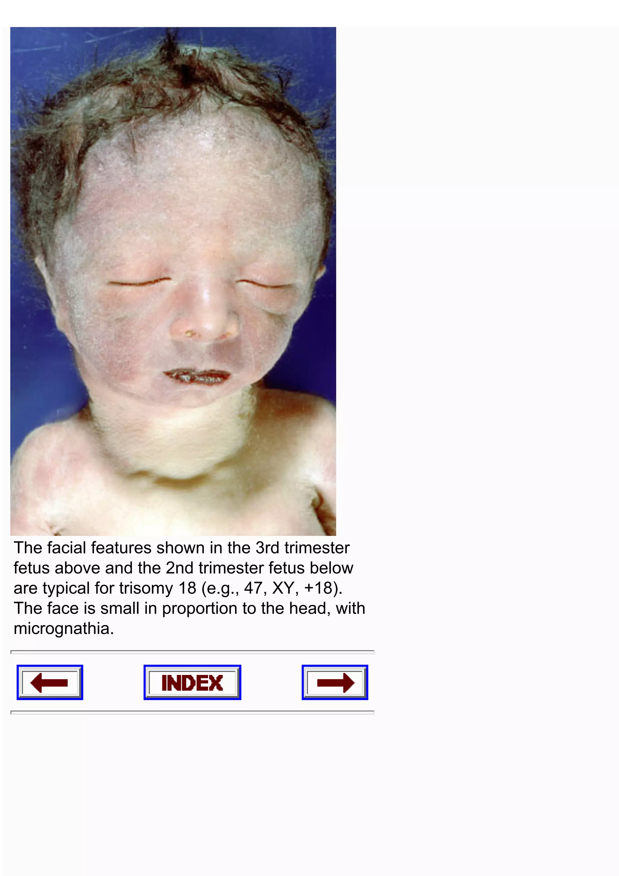 Atlas pediatric perinatal pathology | PDF