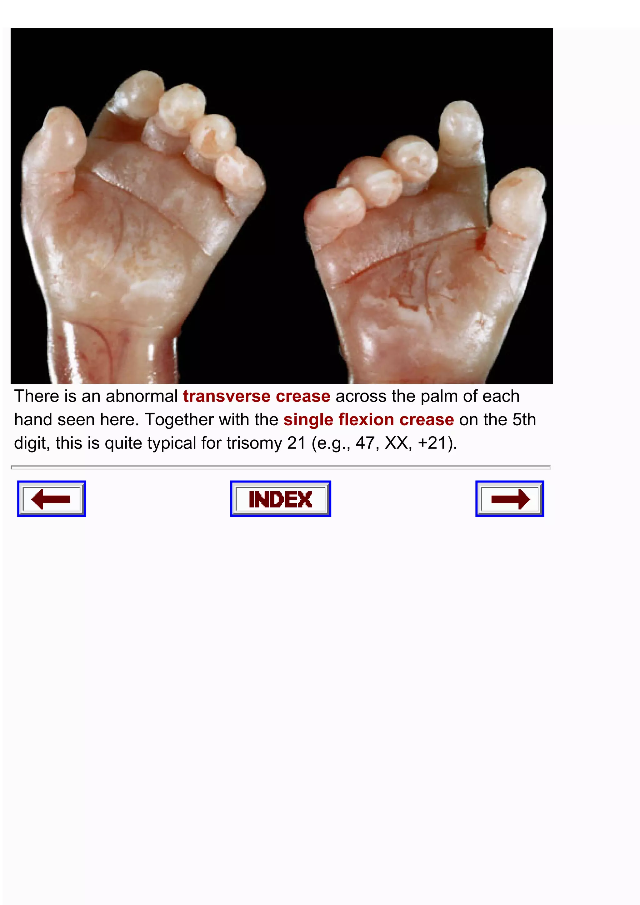 Atlas pediatric perinatal pathology | PDF