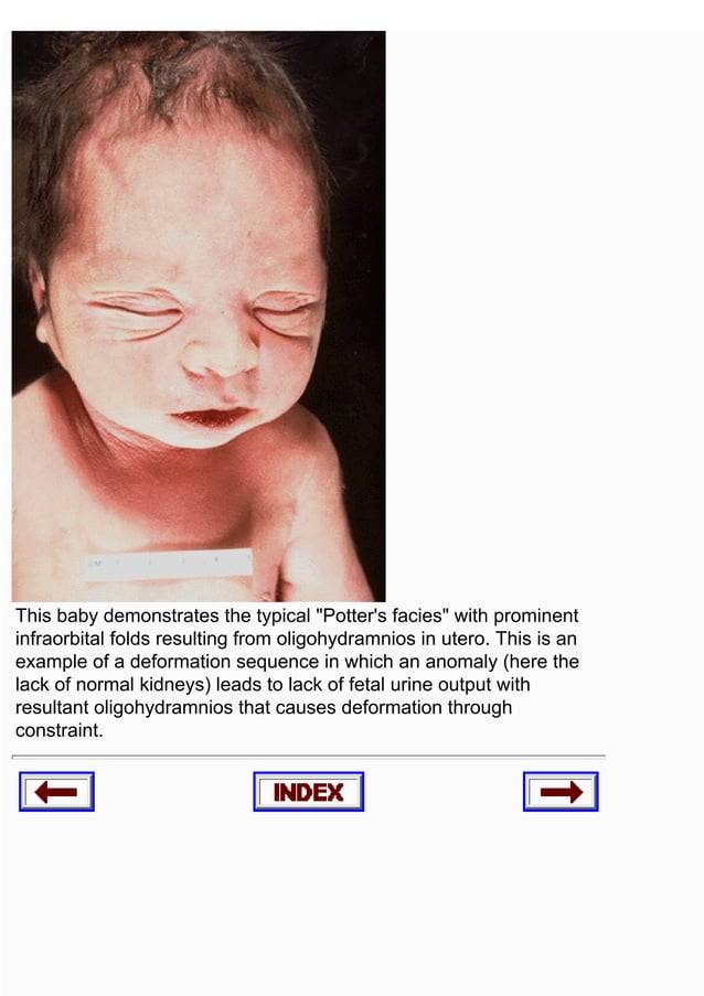 Atlas pediatric perinatal pathology | PDF | Pregnancy | Reproductive Health