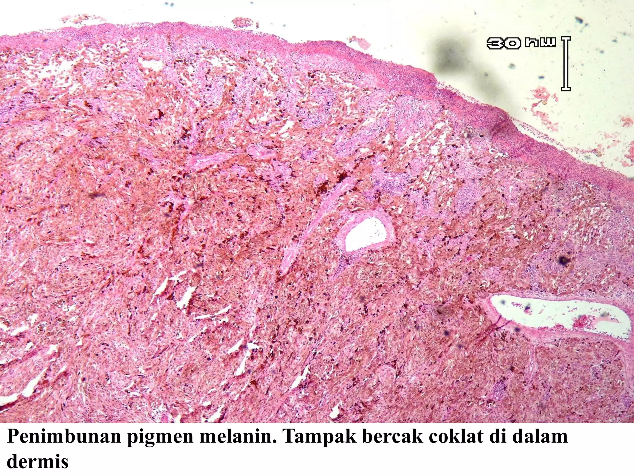 Atlas Praktikum BMD (Patologi Anatomi) (1) (1).pdf