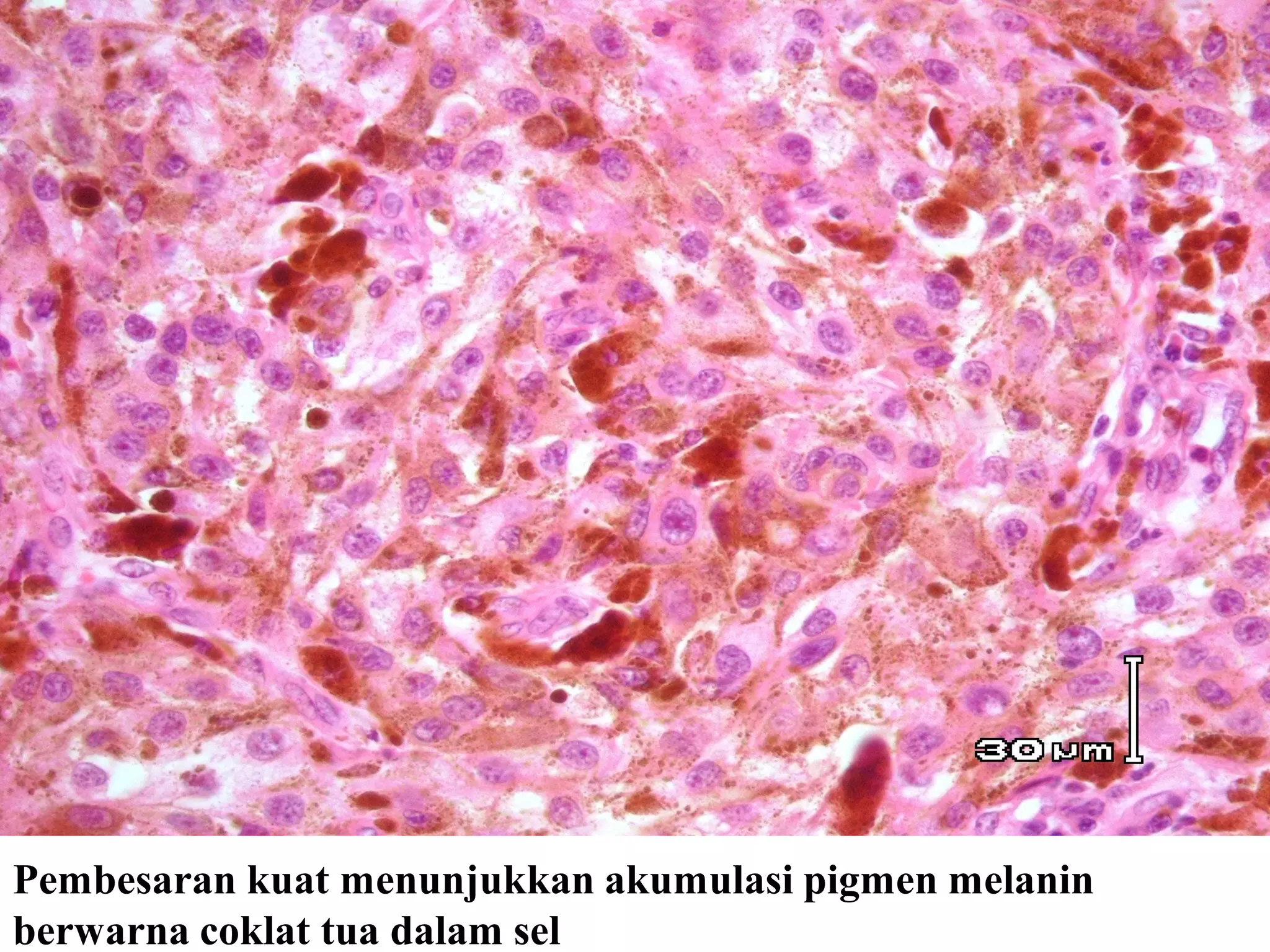 Atlas Praktikum BMD (Patologi Anatomi) (1) (1).pdf