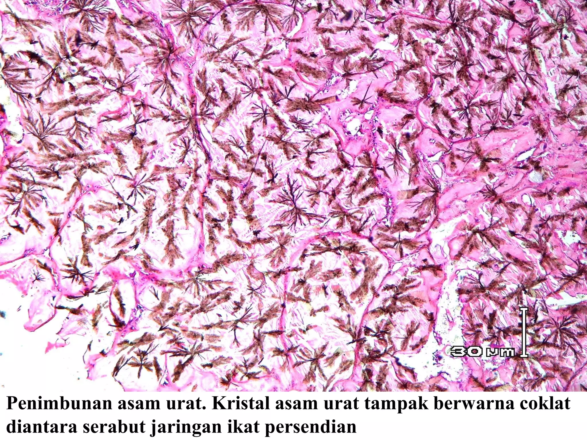 Atlas Praktikum BMD (Patologi Anatomi) (1) (1).pdf