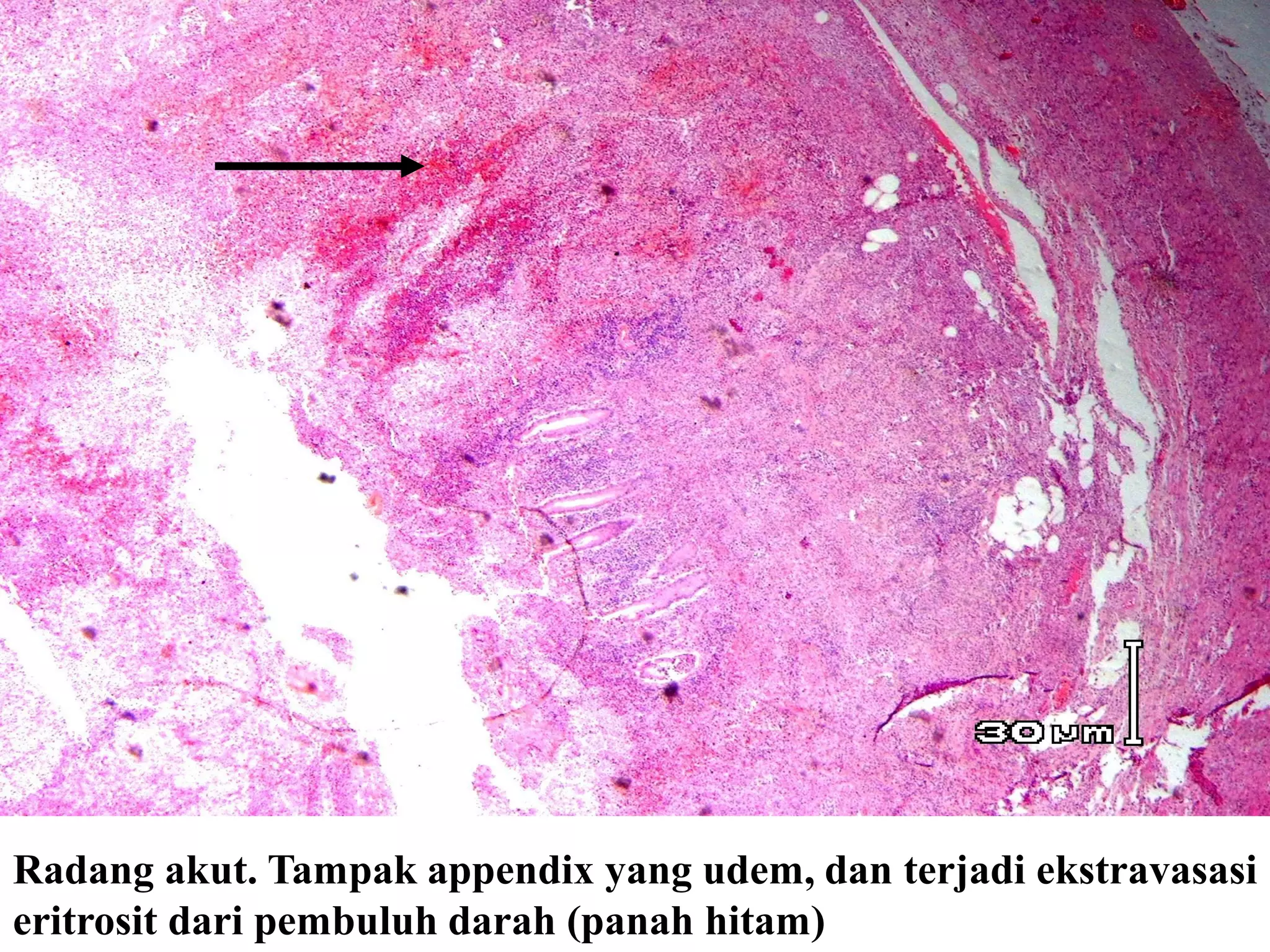 Atlas Praktikum BMD (Patologi Anatomi) (1) (1).pdf