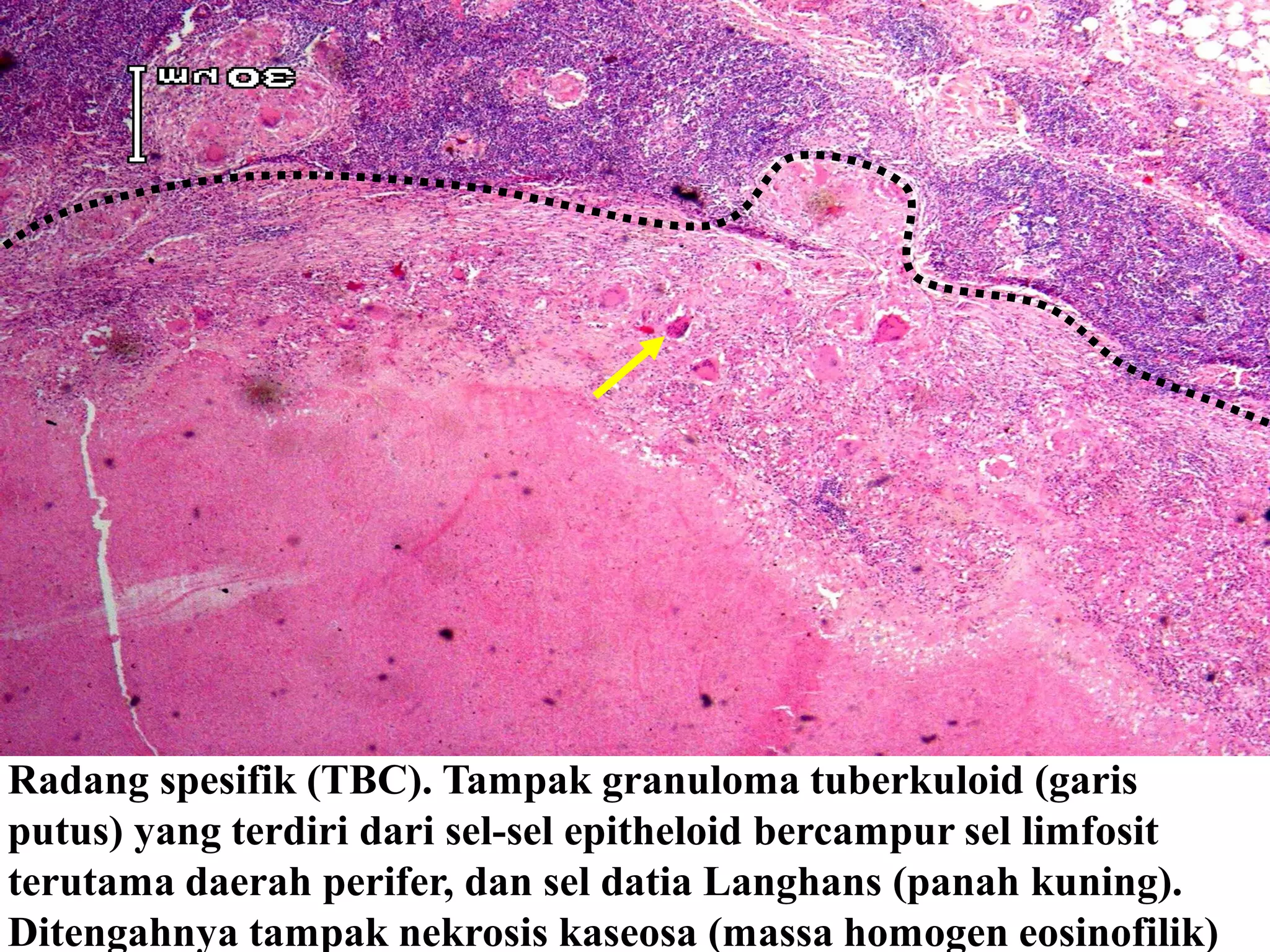 Atlas Praktikum BMD (Patologi Anatomi) (1) (1).pdf