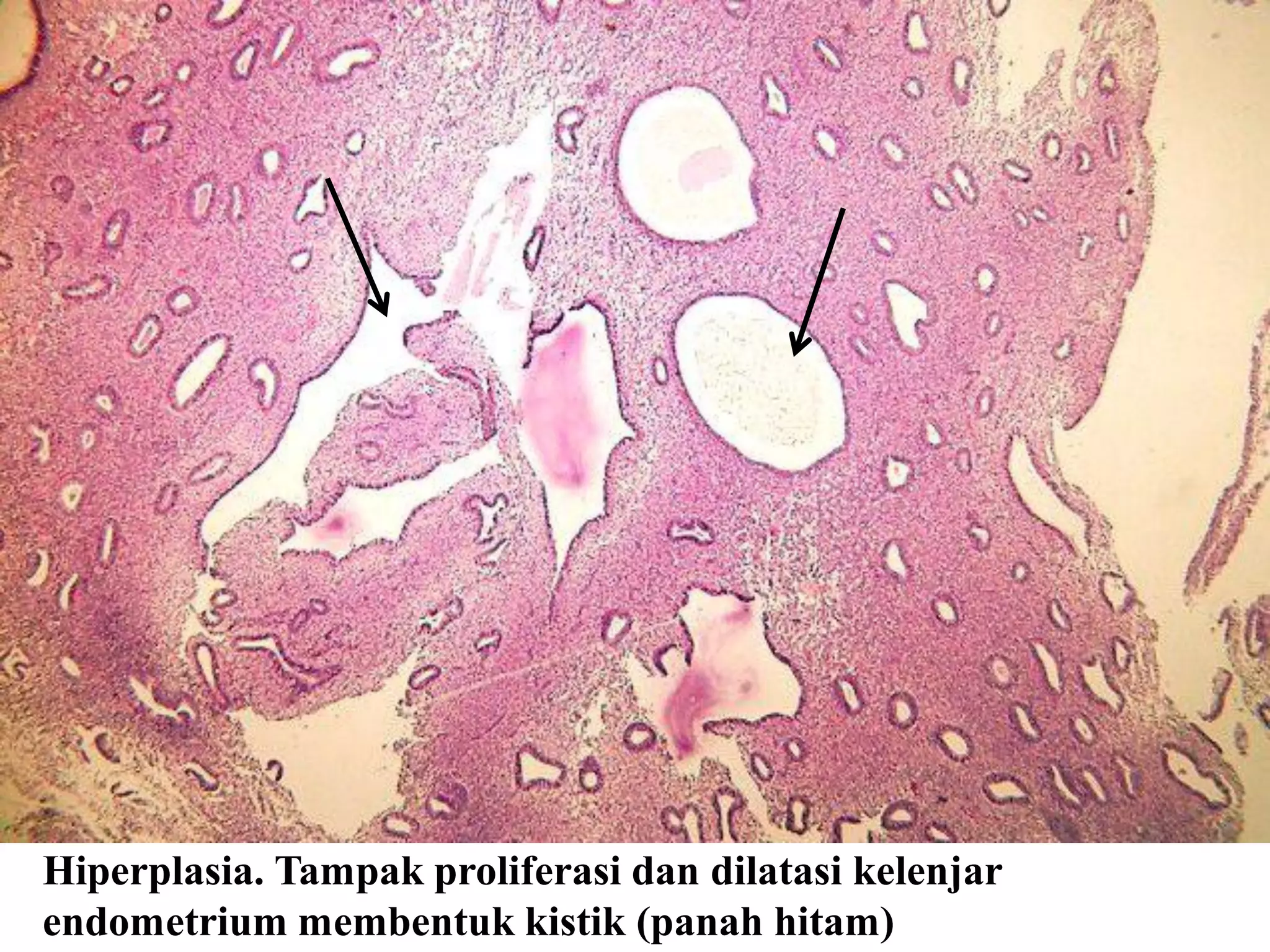 Atlas Praktikum BMD (Patologi Anatomi) (1) (1).pdf