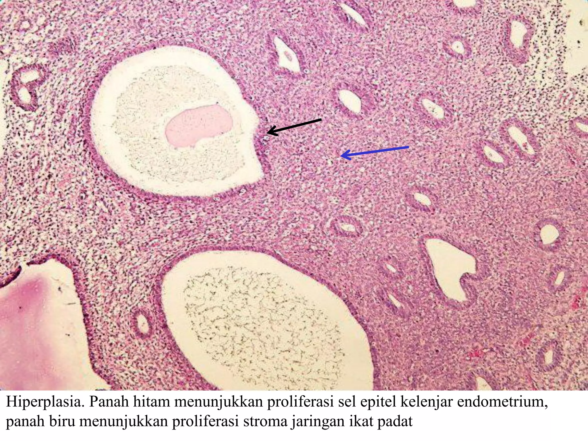Atlas Praktikum BMD (Patologi Anatomi) (1) (1).pdf