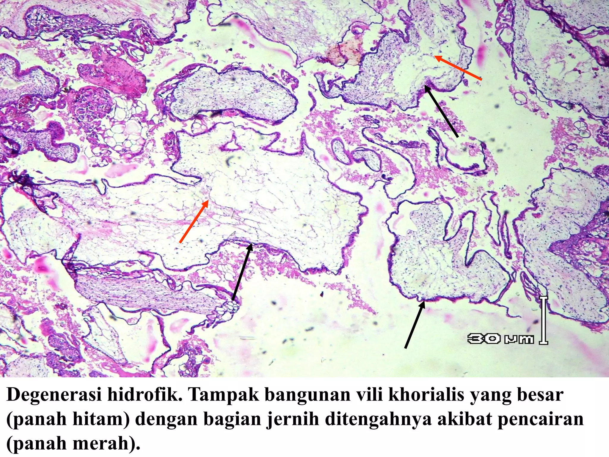Atlas Praktikum BMD (Patologi Anatomi) (1) (1).pdf