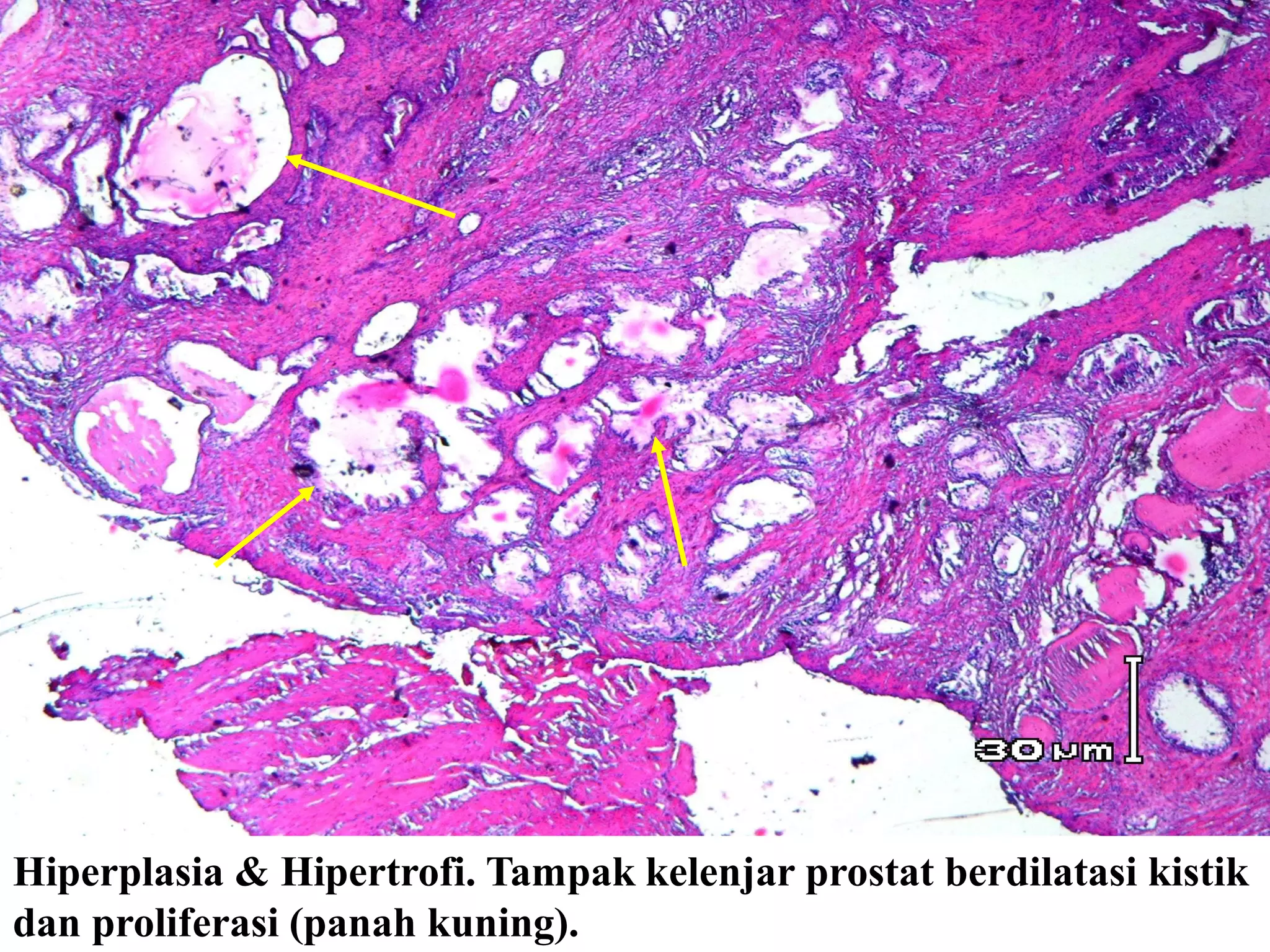 Atlas Praktikum BMD (Patologi Anatomi) (1) (1).pdf