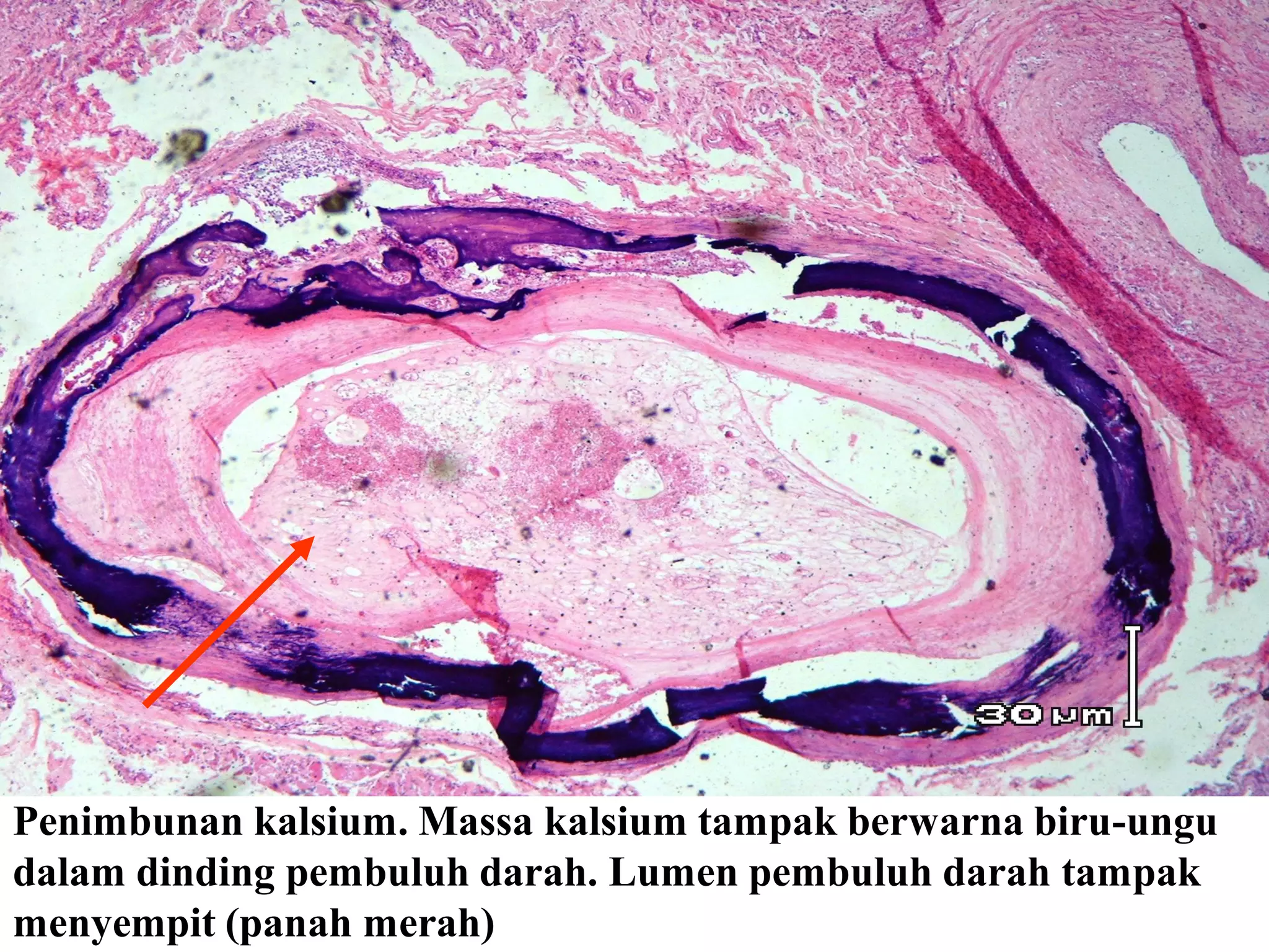 Atlas Praktikum BMD (Patologi Anatomi) (1) (1).pdf