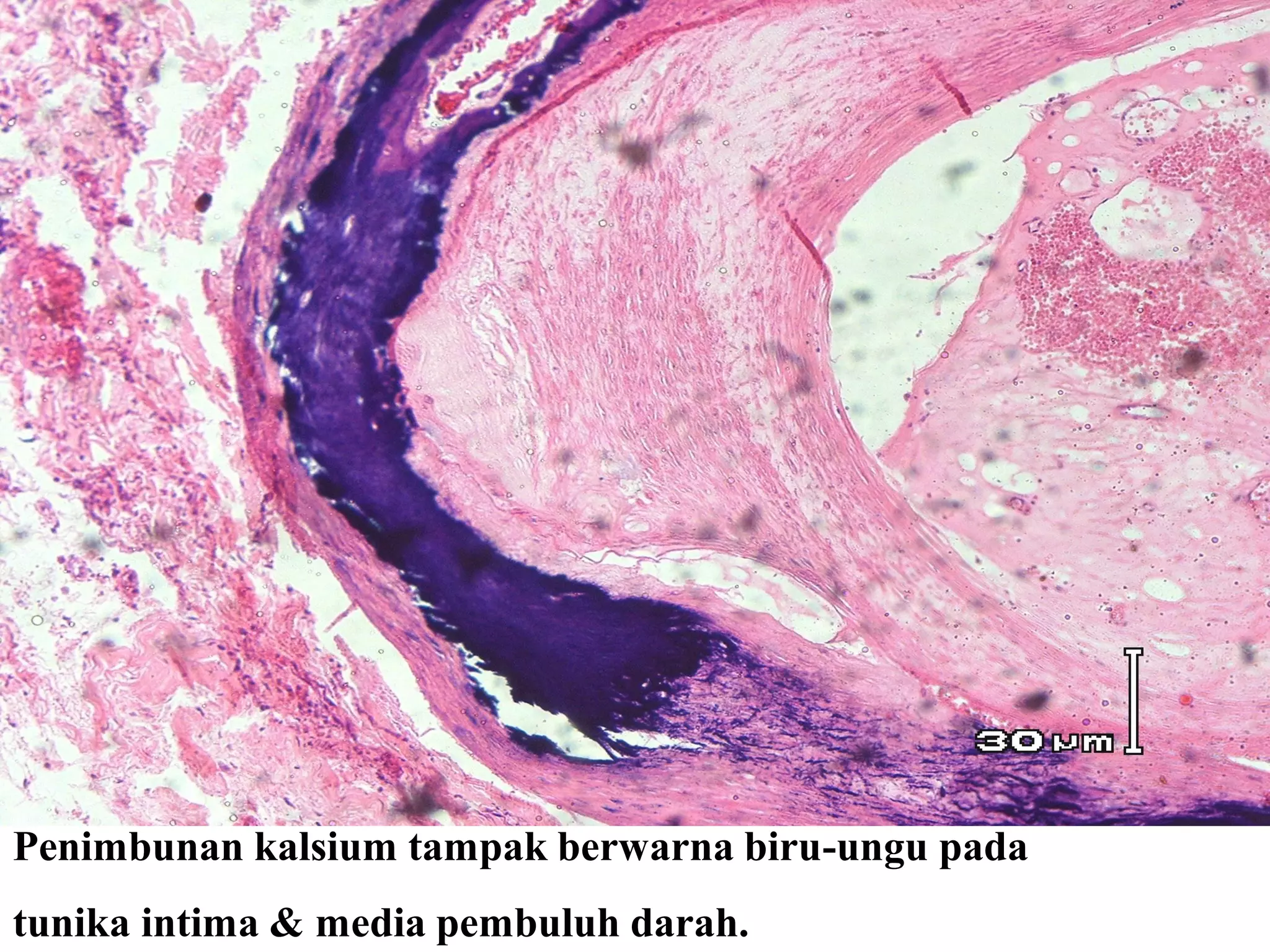 Atlas Praktikum BMD (Patologi Anatomi) (1) (1).pdf